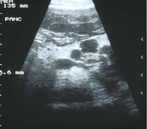 2000 – Cystic Fibrosis Medicine