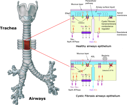 Aztreonam review (iv) – Cystic Fibrosis Medicine